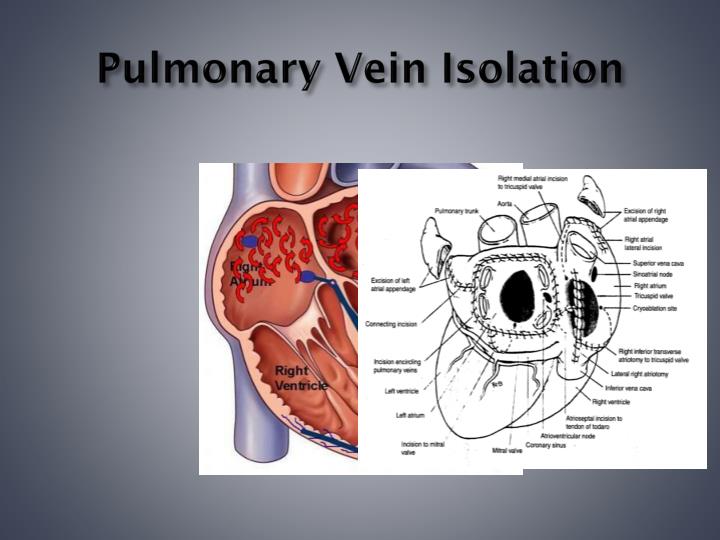 PPT - Atrial fibrillation: 2011 Updates PowerPoint Presentation - ID ...