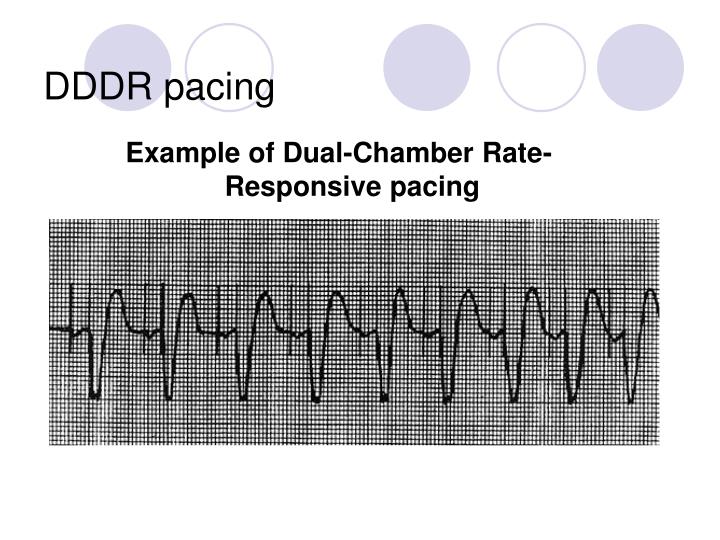 PPT - Cardiac Implantable Devices PowerPoint Presentation - ID:4016090