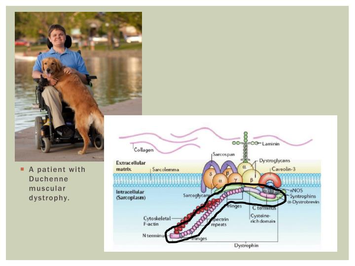 PPT - Duchenne muscular dystrophy (DMD) PowerPoint Presentation - ID ...