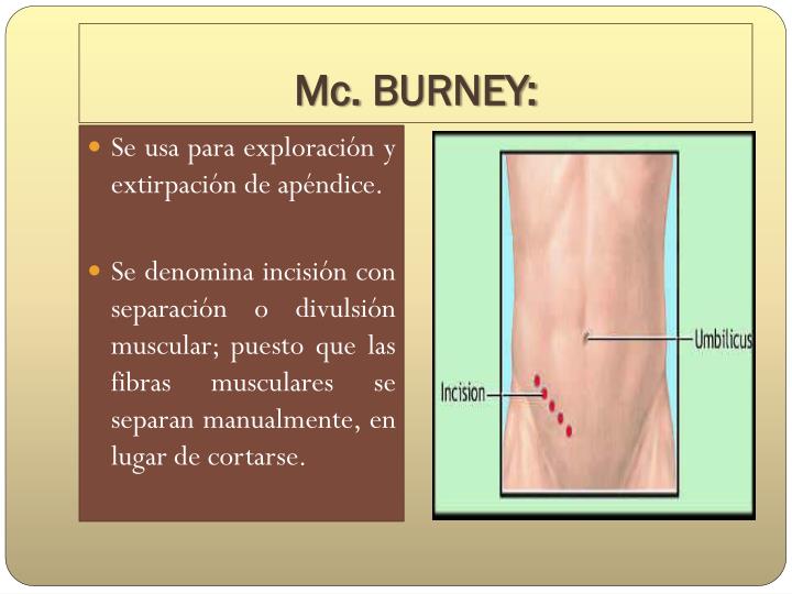 PPT - INCISIONES QUIRÚRGICAS PowerPoint Presentation - ID:4019214
