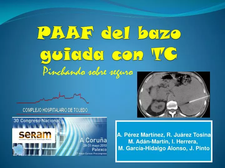 PPT - PAAF del bazo guiada con TC PowerPoint Presentation, free ...