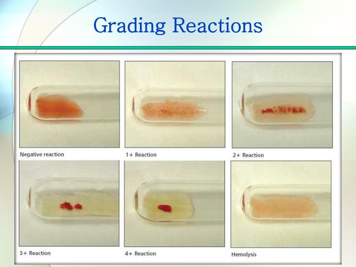 PPT - Practical Blood Bank PowerPoint Presentation - ID:4024679