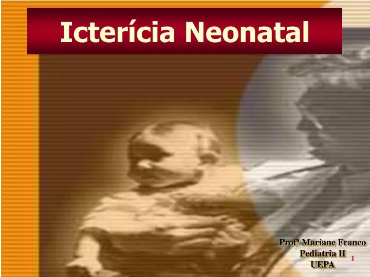 PPT - Icterícia Neonatal PowerPoint Presentation, free download - ID ...