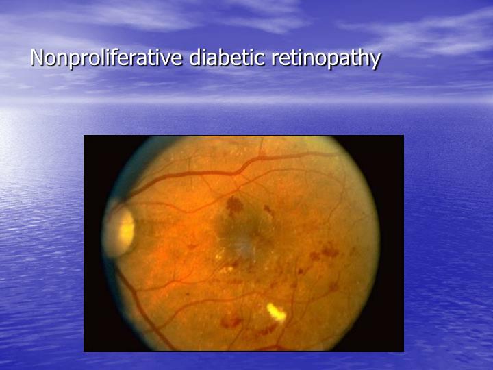 PPT - Lecture 3 EYE CHANGES IN SYSTEMIC DISEASES EMMERGENCY IN ...