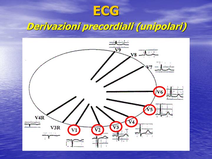 PPT - L’ECG normale PowerPoint Presentation - ID:4026843