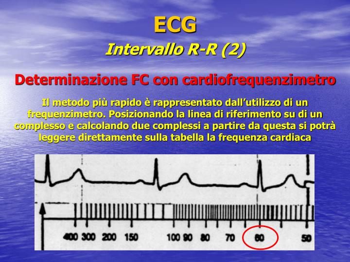 PPT - L’ECG normale PowerPoint Presentation - ID:4026843