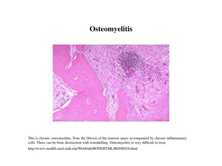 PPT - Part 3: Bone Pathology PowerPoint Presentation - ID:4037592