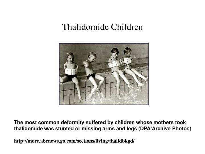 PPT - Part 3: Bone Pathology PowerPoint Presentation - ID:4037592