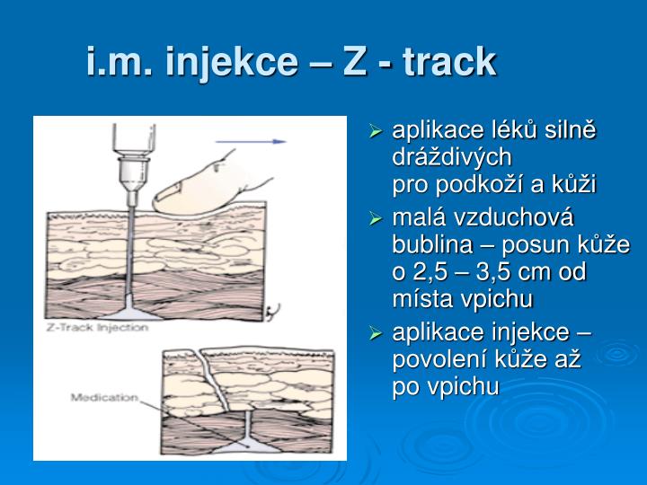 PPT - Aplikace léků parenterální cestou INJEKCE intramusculární injekce ...