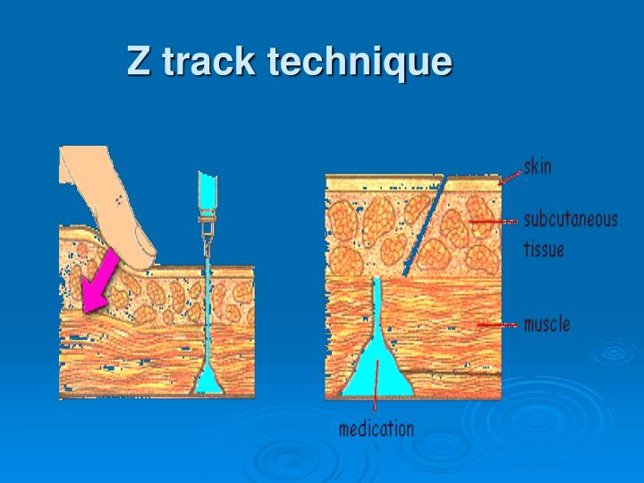 PPT - Aplikace léků parenterální cestou INJEKCE intramusculární injekce ...