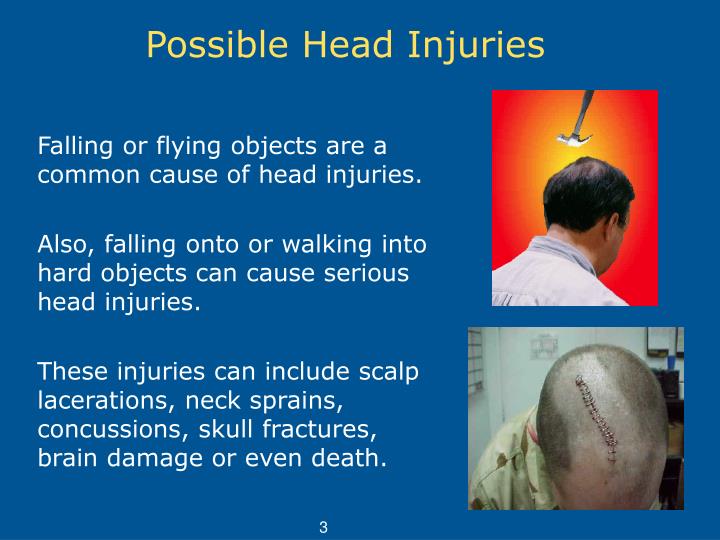 PPT - Head Protection (Hard Hats) PowerPoint Presentation - ID:4038970