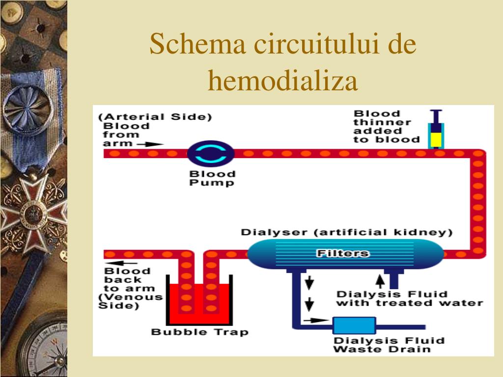 PPT - DIALIZA PERITONEALĂ SI HEMODIALIZA PowerPoint Presentation, free ...