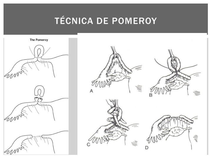 PPT - MÉTODOS ANTICONCEPTIVOS PowerPoint Presentation - ID:4046361
