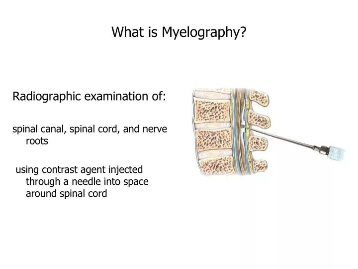 PPT - What is Myelography? PowerPoint Presentation, free download - ID ...