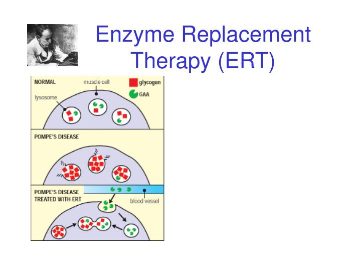 PPT - Pompe disease: a case study of the development of a successful ...