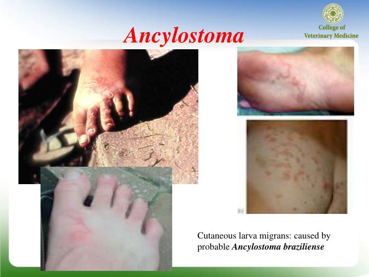 PPT - Phylum: Nemathelminthes Class: Nematoda Ancylostoma PowerPoint ...