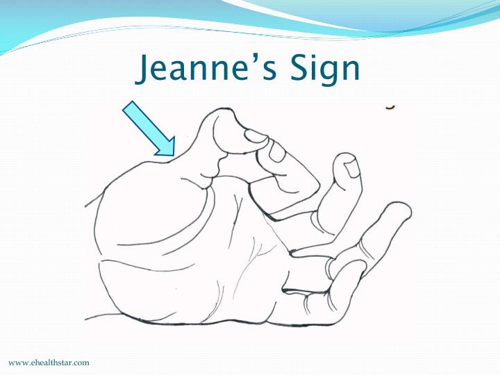 PPT - Therapy Considerations for the Ulnar Nerve PowerPoint ...