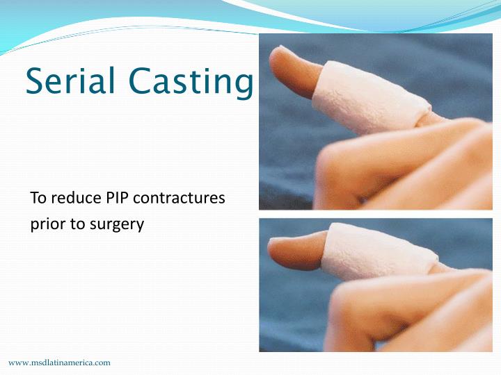 PPT - Therapy Considerations for the Ulnar Nerve PowerPoint ...