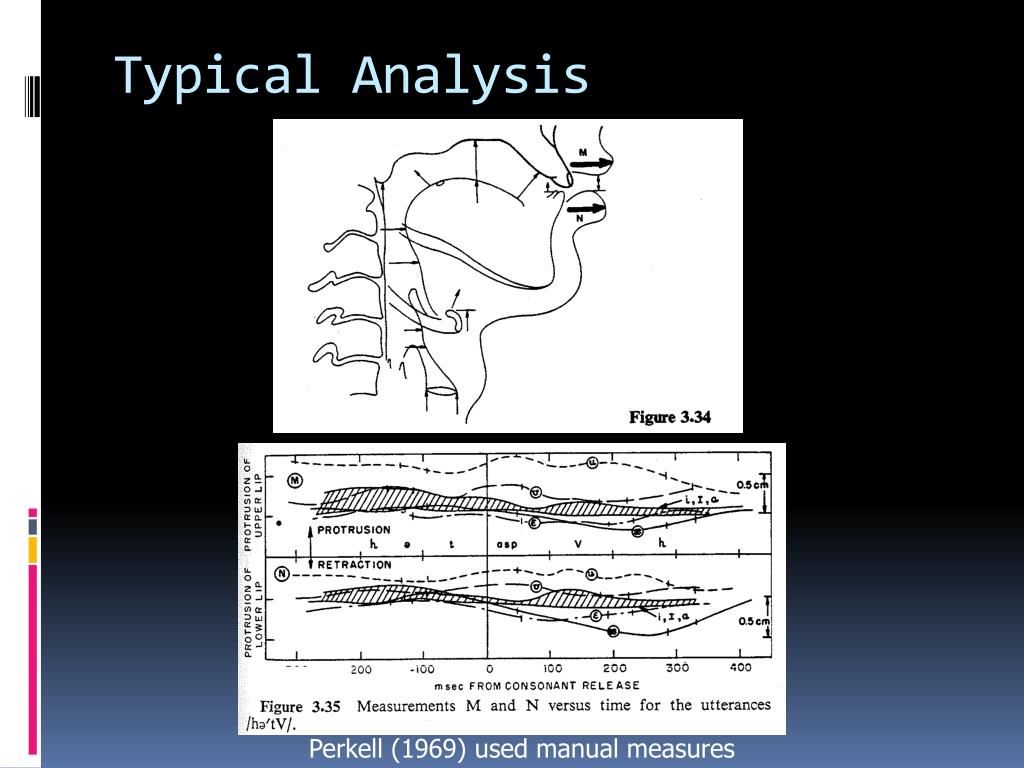 PPT - Image Processing Algorithm for Speech Acoustics PowerPoint ...