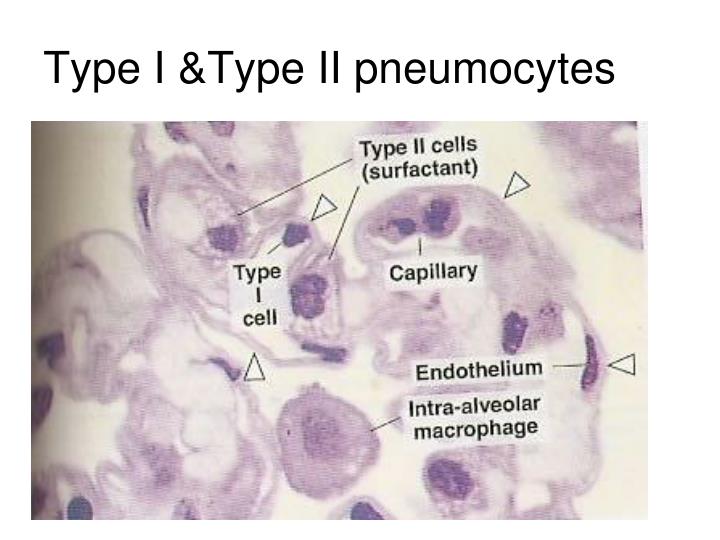 PPT - Bronchial Tree PowerPoint Presentation - ID:4063967