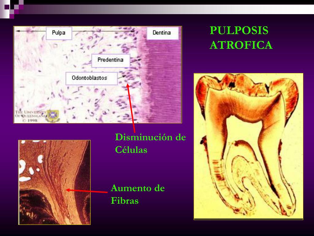 PPT - UNIVERSIDAD DE SAN CARLOS DE GUATEMALA PowerPoint Presentation ...