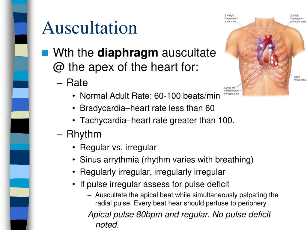 PPT - Heart/Neck Vessels & Peripheral Vascular/Lymphatics PowerPoint ...