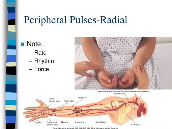 PPT - Heart/Neck Vessels & Peripheral Vascular/Lymphatics PowerPoint Presentation - ID:4071591