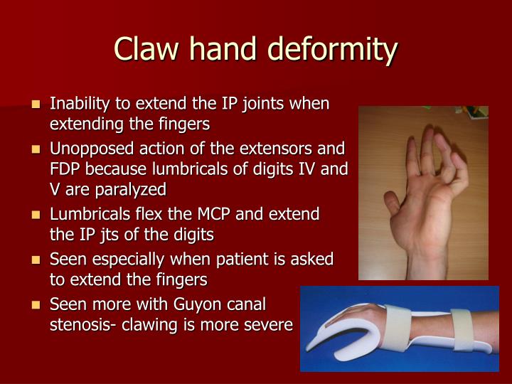 PPT - Inclusion Body Myositis PowerPoint Presentation - ID:4073591