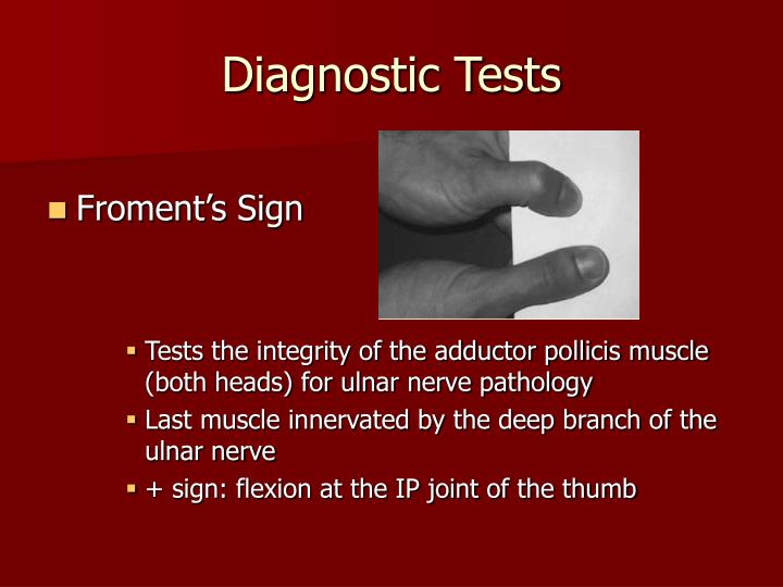 Ppt Inclusion Body Myositis Powerpoint Presentation Id4073591