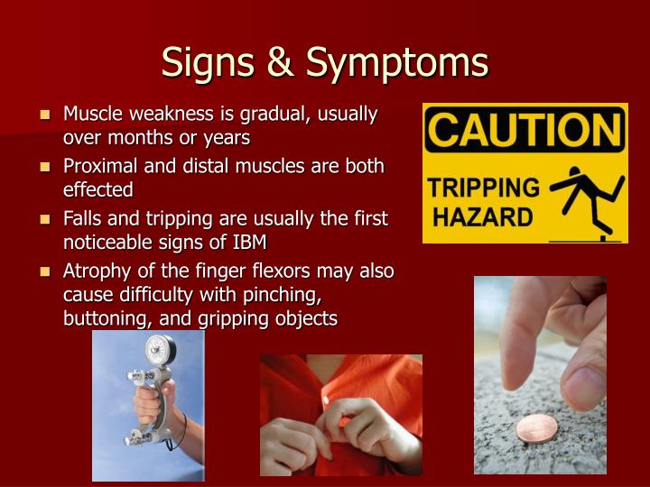 PPT - Inclusion Body Myositis PowerPoint Presentation - ID:4073591