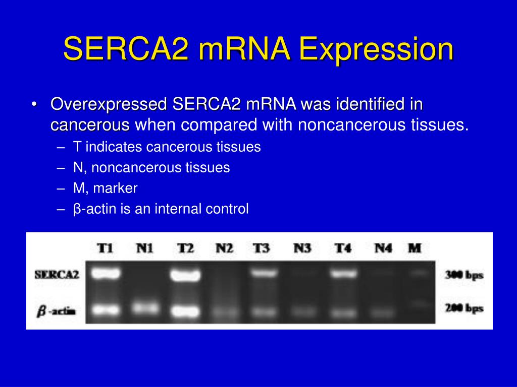 PPT - Sarco/Endoplasmic Reticulum Calcium-ATPase 2 Expression as a ...