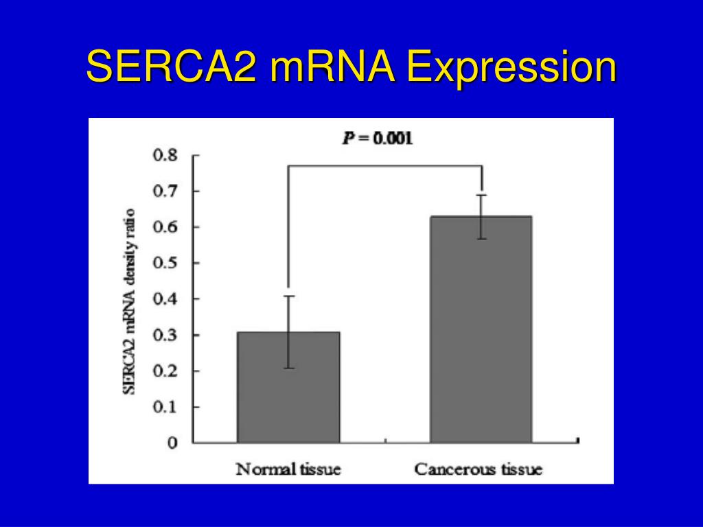 PPT - Sarco/Endoplasmic Reticulum Calcium-ATPase 2 Expression as a ...