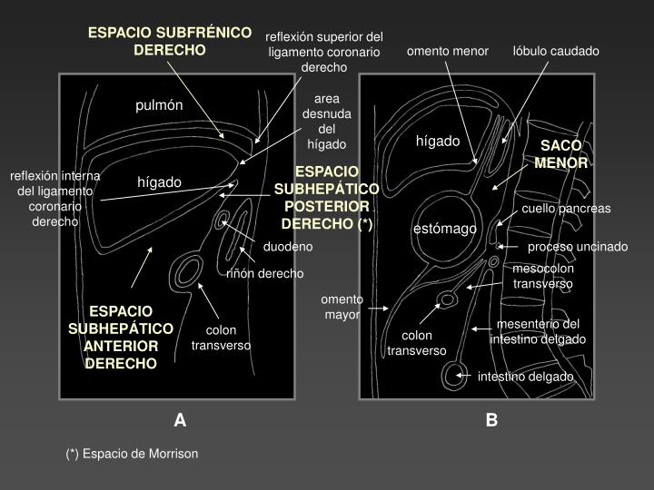 PPT - Anatomía de la cavidad peritoneal superior PowerPoint ...