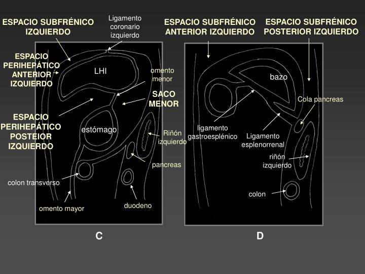 PPT - Anatomía de la cavidad peritoneal superior PowerPoint ...