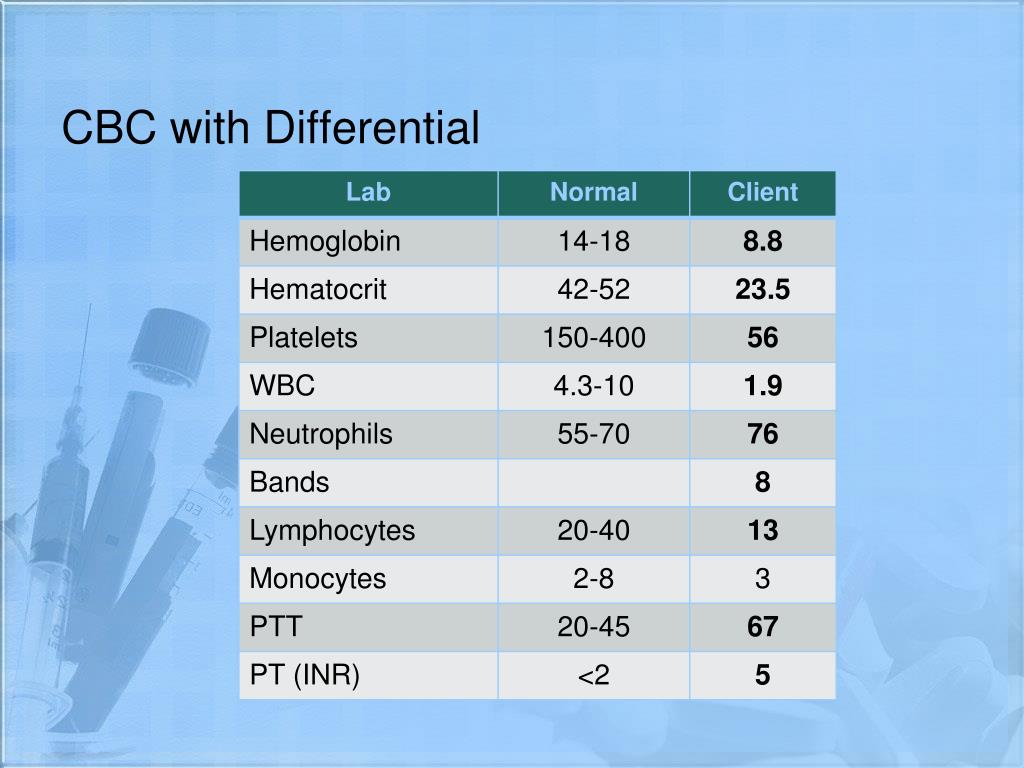 Cbc Differential High Bands at Lorri Lintz blog Cbc Differential High Bands at Lorri Lintz blog