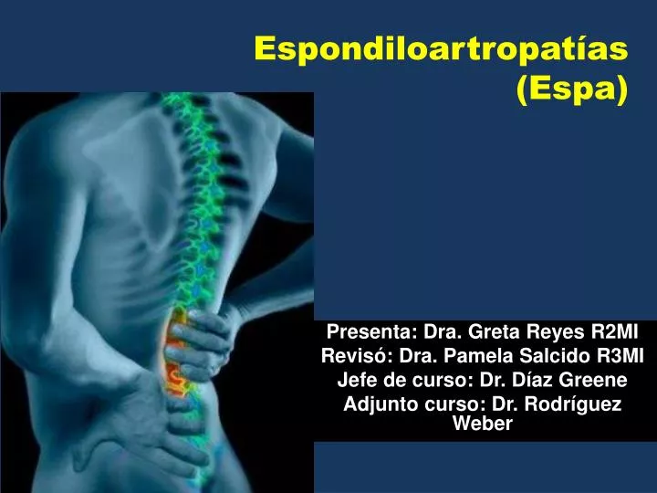 PPT - Espondiloartropatías (Espa) PowerPoint Presentation, free ...