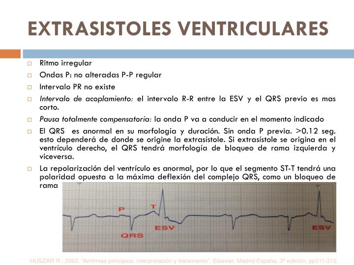 PPT - Extrasístoles y Síndromes de preexitación: WPW y Long-Ganong-L ...
