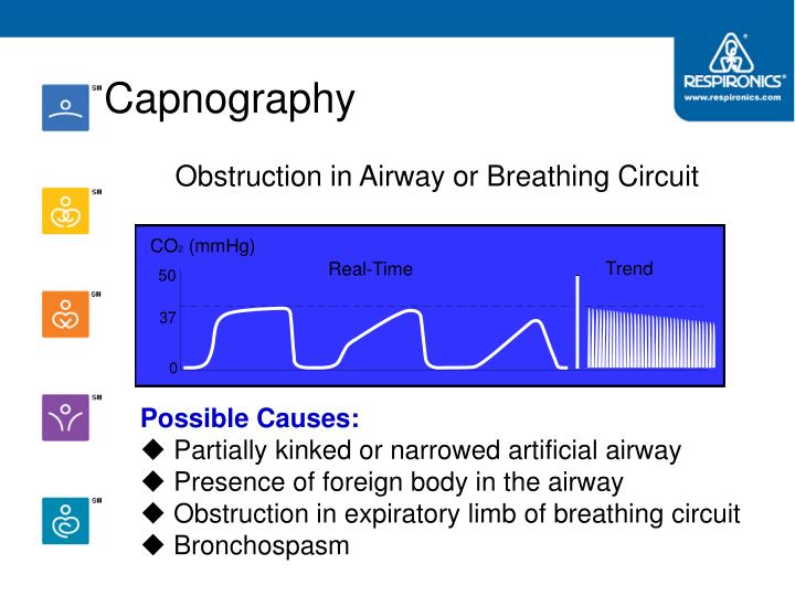 PPT - Capnography PowerPoint Presentation - ID:4082923