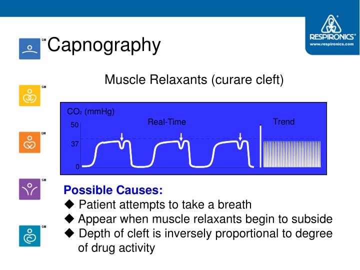 PPT - Capnography PowerPoint Presentation - ID:4082923
