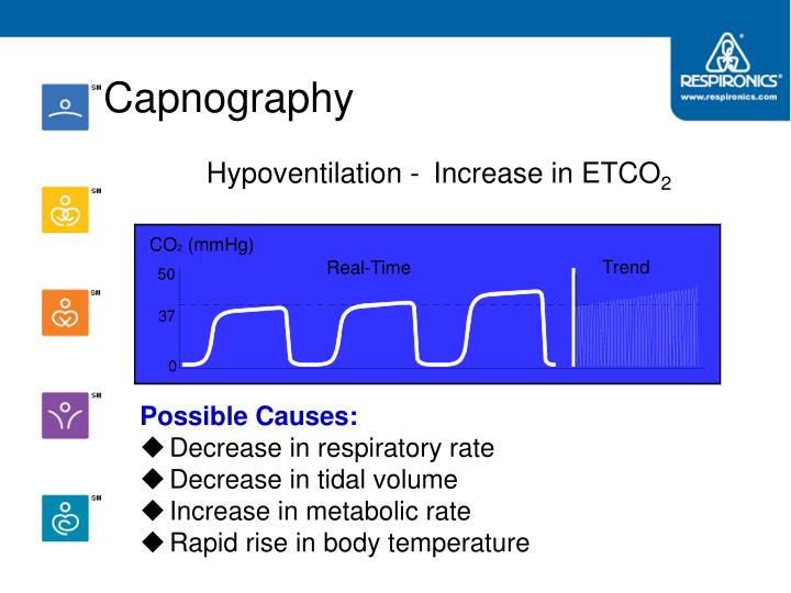 PPT - Capnography PowerPoint Presentation - ID:4082923