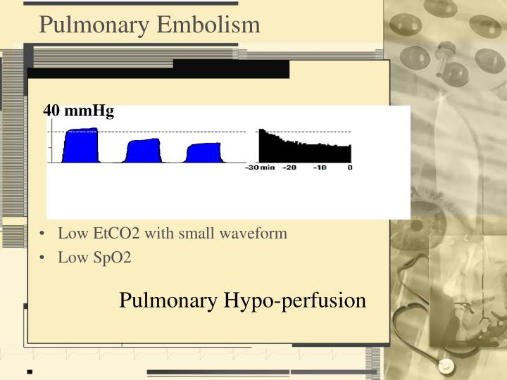 PPT - Capnography for EMS PowerPoint Presentation - ID:4082968