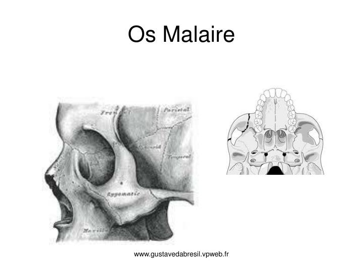 PPT - Squelette de la face PowerPoint Presentation - ID:4083934