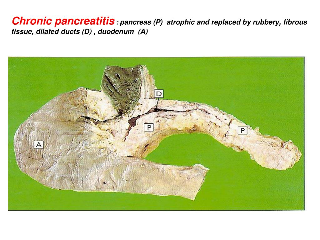 PPT - Describe etio-pathogenesis and morphology of: Acute and chronic ...