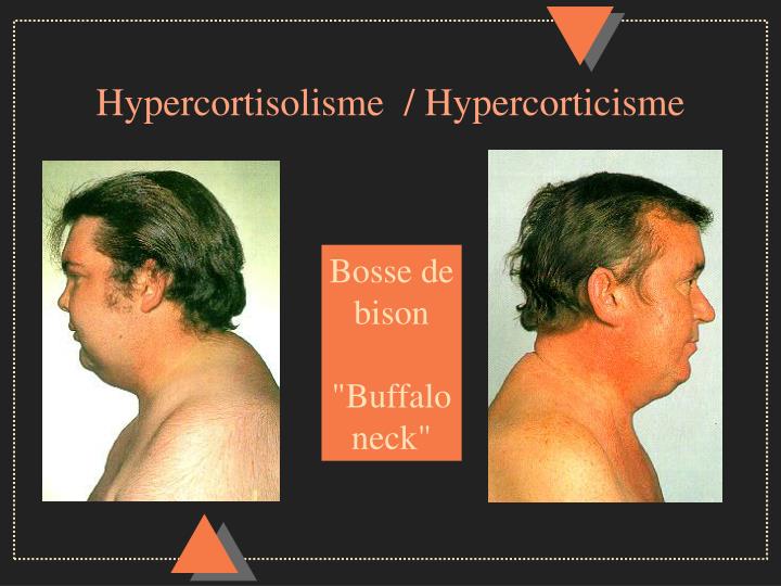 PPT - Sémiologie PowerPoint Presentation - ID:4090413