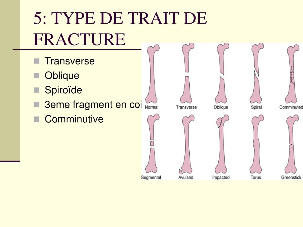 PPT - IFSI ROBERT BALLANGER 1 ère ANNEE PROCESSUS TRAUMATIQUES ET ...