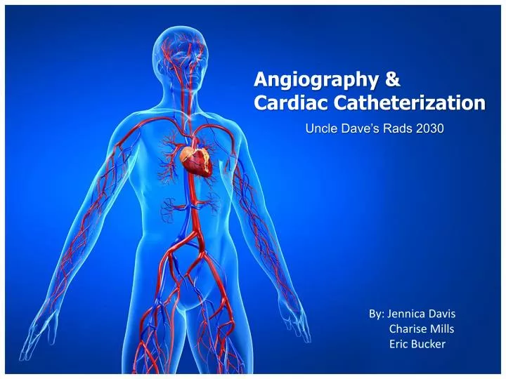 Ppt Angiography And Cardiac Catheterization Powerpoint Presentation