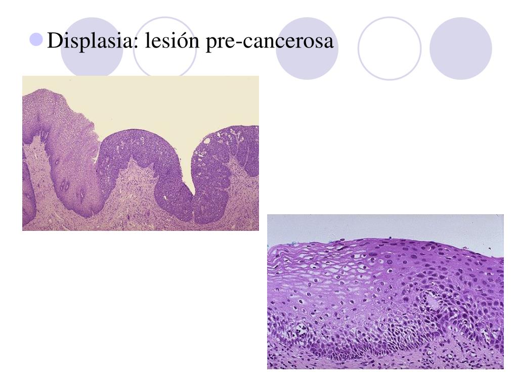 PPT - UNIDAD 6 Patología general de las neoplasias PowerPoint ...