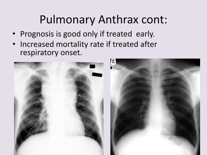 PPT - Unit F: Infectious Diseases PowerPoint Presentation - ID:4106427