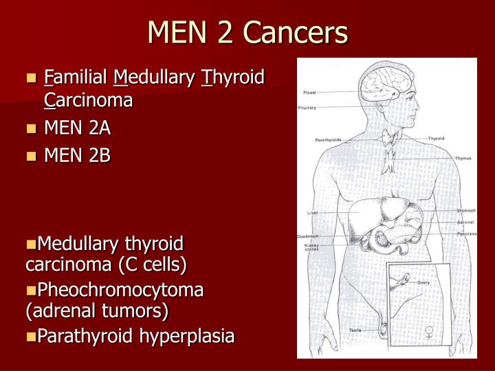 PPT - RET and MEN2 PowerPoint Presentation - ID:4110577