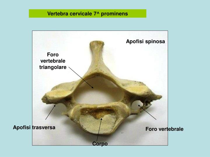 PPT - cranio PowerPoint Presentation - ID:4115518